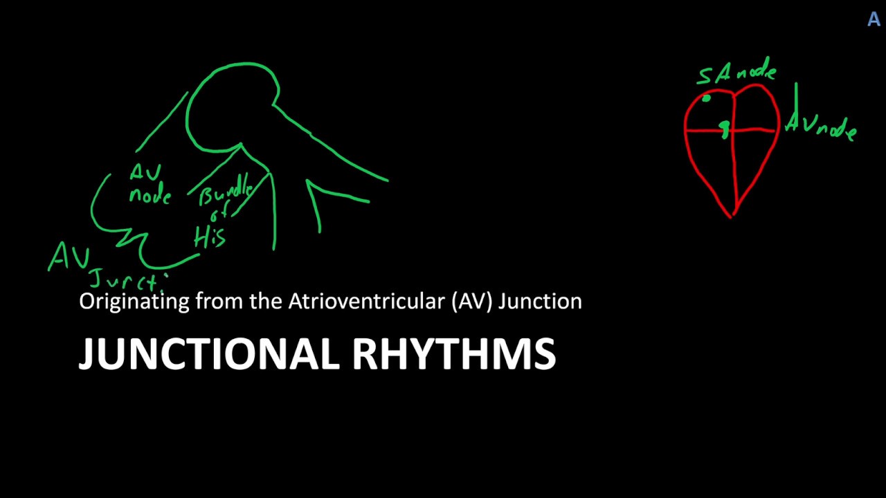 Advanced Arrhythmia: Junctional Rhythms Lesson - YouTube
