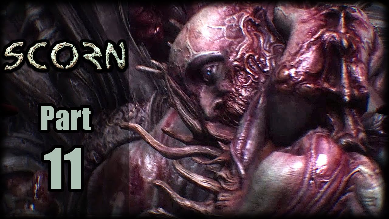ENDLICH WERDEN WIR OPERIERT || SCORN || Part 11 || Let's Play Deutsch - YouTube