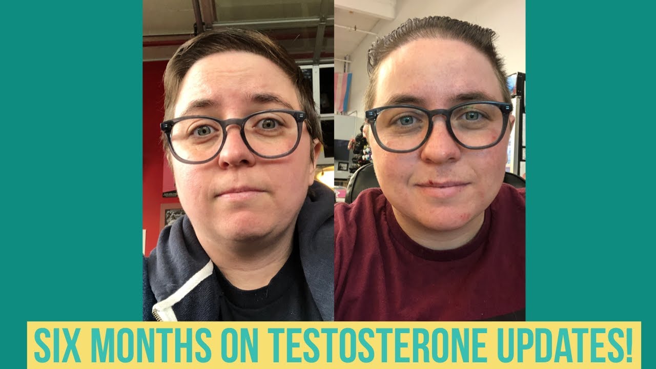 Six Months On Testosterone! - YouTube
