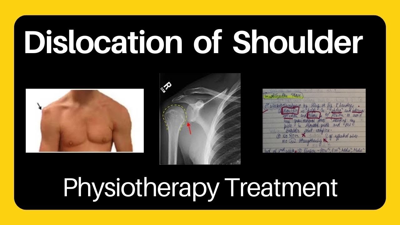 Dislocation Of Shoulder- Anterior, Posterior, Inferior & its ...