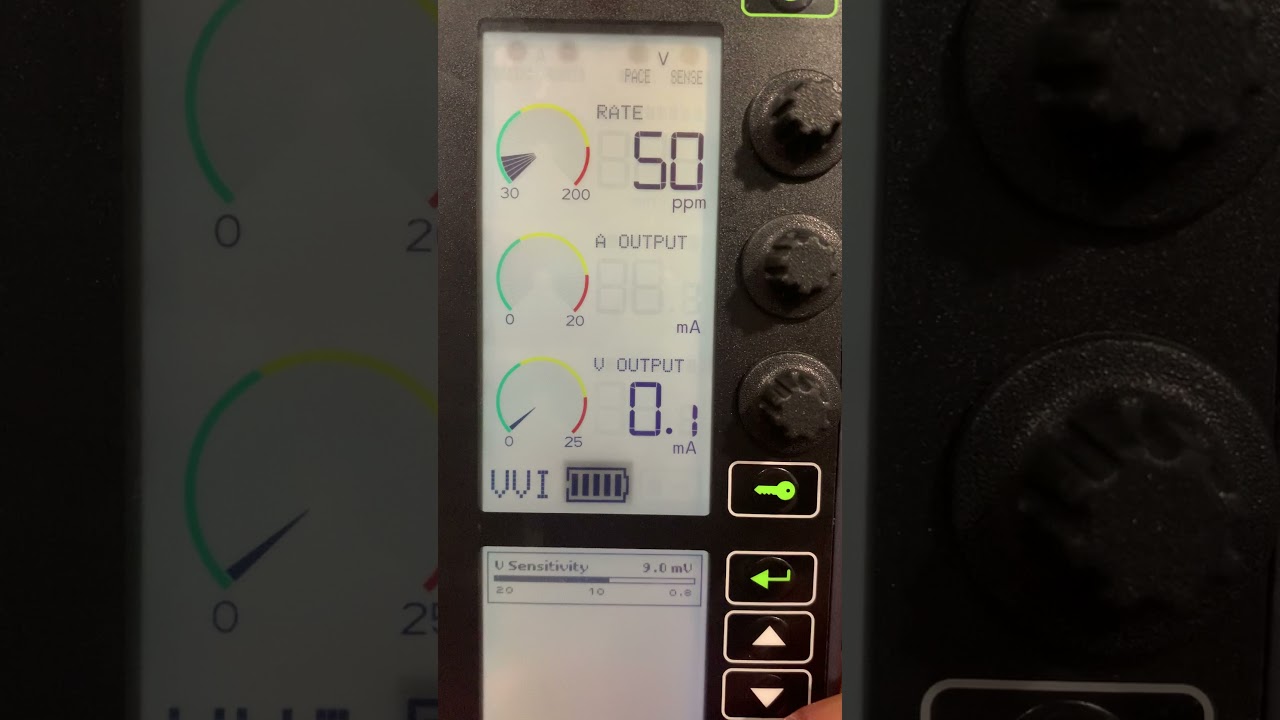 pacemaker interrogation sensitivity - YouTube