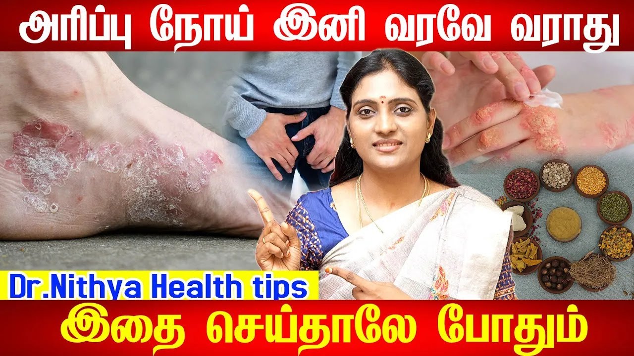 கரப்பான் நோய் குணமாக | Karappan skin disease in tamil | eczema ...