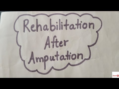 Rehabilitation After Amputation|Stages Of Rehabilitation After ...