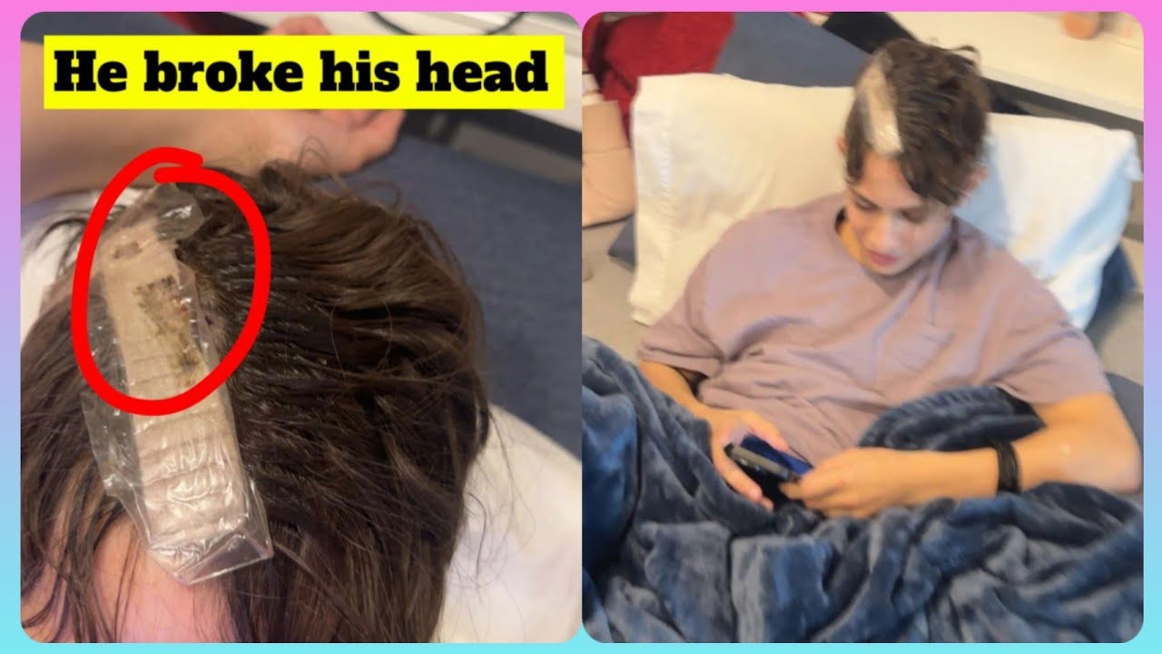 Nidal Wonder BROKE His HEAD Again 2nd Time - YouTube