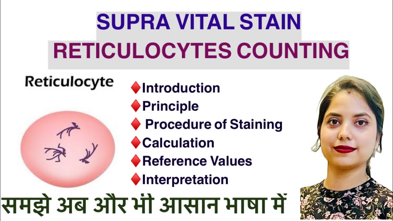 Supra vital Stain | Reticulocytes Counting in Hindi | MLT | Haematology ...