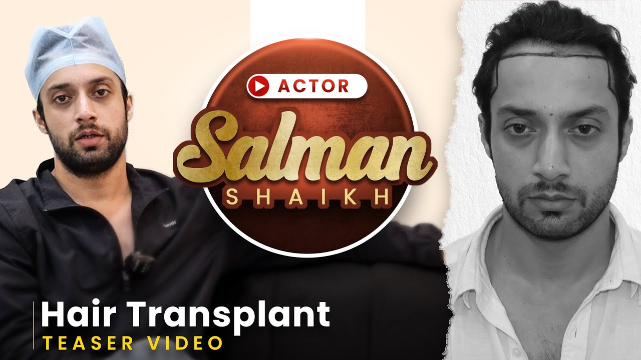 Bollywood ACTOR & ANCHOR Salman Shaikh's Hair Transplant at Hairfree ...
