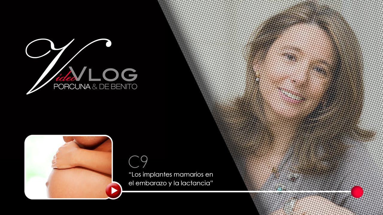Capítulo 9 - Los implantes mamarios en el embarazo y la lactancia - YouTube