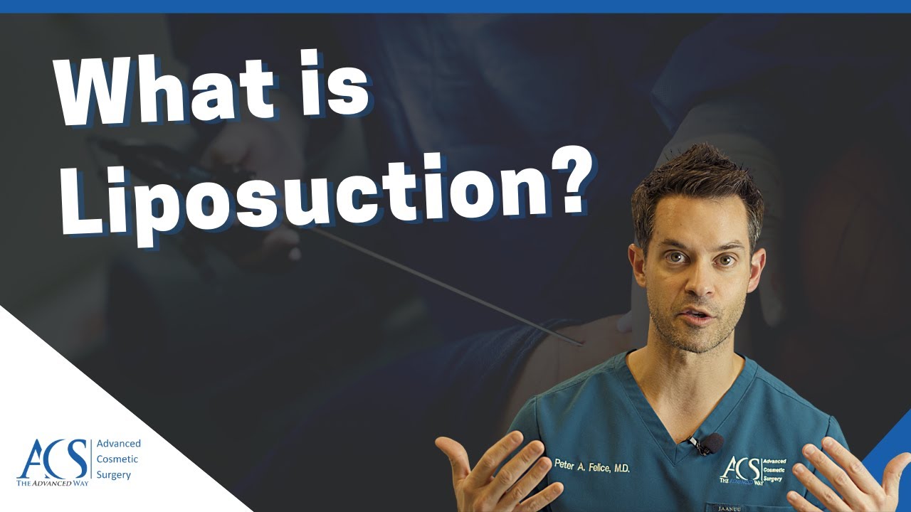 Liposuction: The Procedure, Weight Loss, Target Areas, Safety and ...