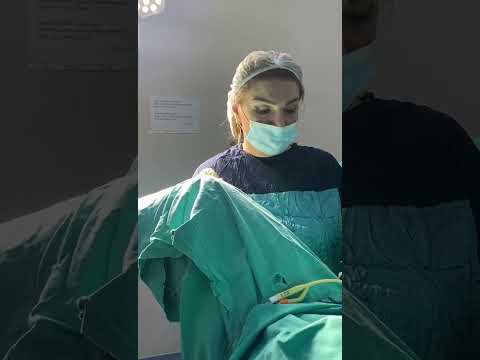 Vaginoplastika əməliyyatı