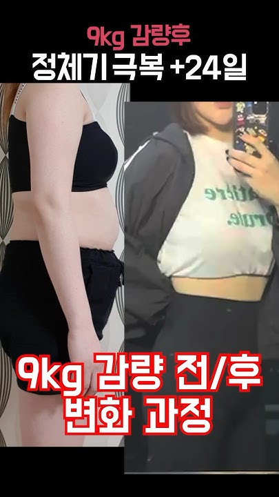 9kg 감량 전후 얼굴 몸 변화🥴 다이어트 정체기 탄수화물중독 Shorts Youtube