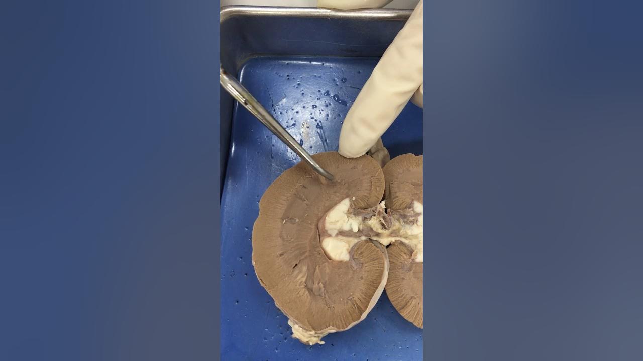 Breckinridge Co. 4-H Kidney Dissection (Sheep) - YouTube