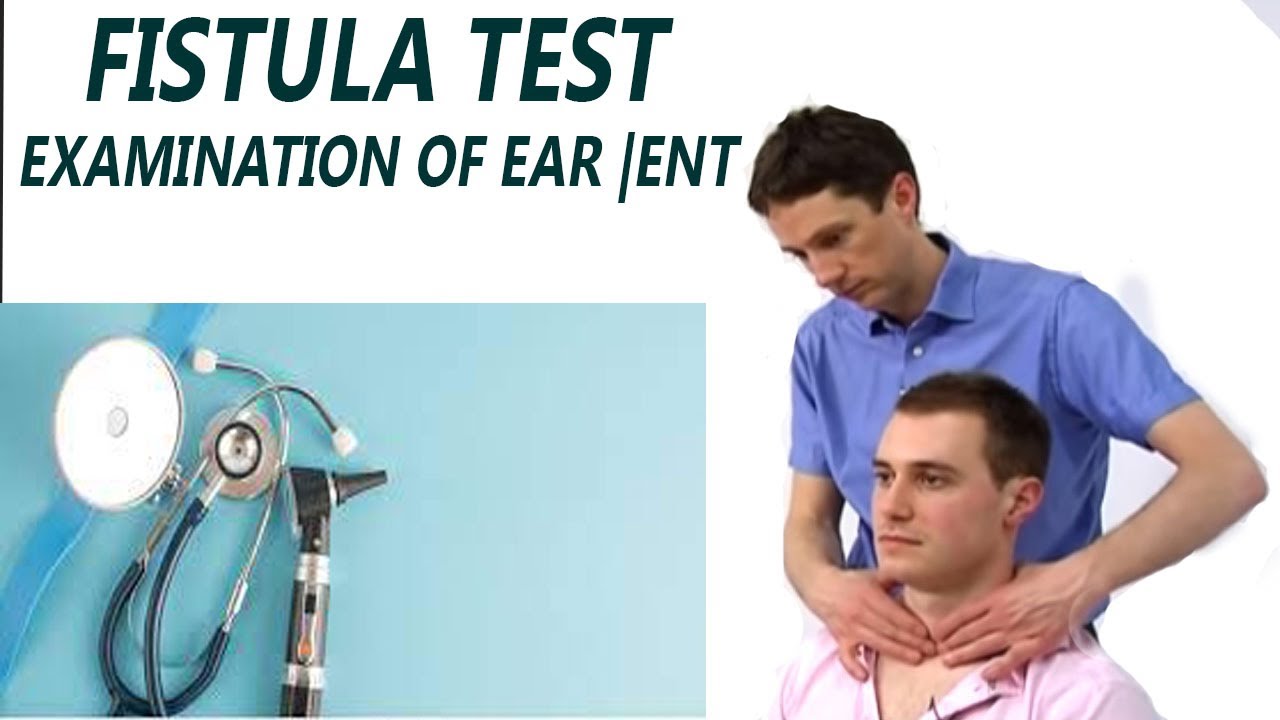 FISTULA TEST | EXAMINATION OF EAR |ENT - YouTube