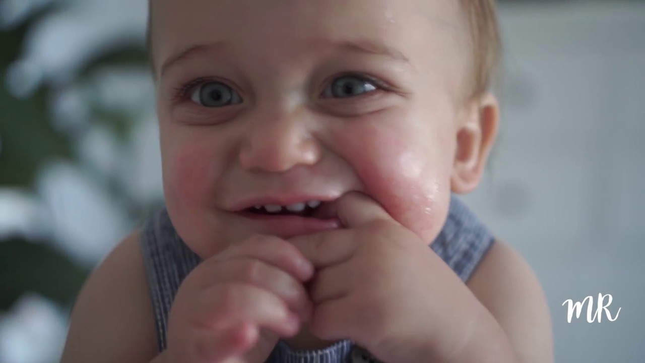 Best Cream For Teething Rash On Face at Greg Howell blog