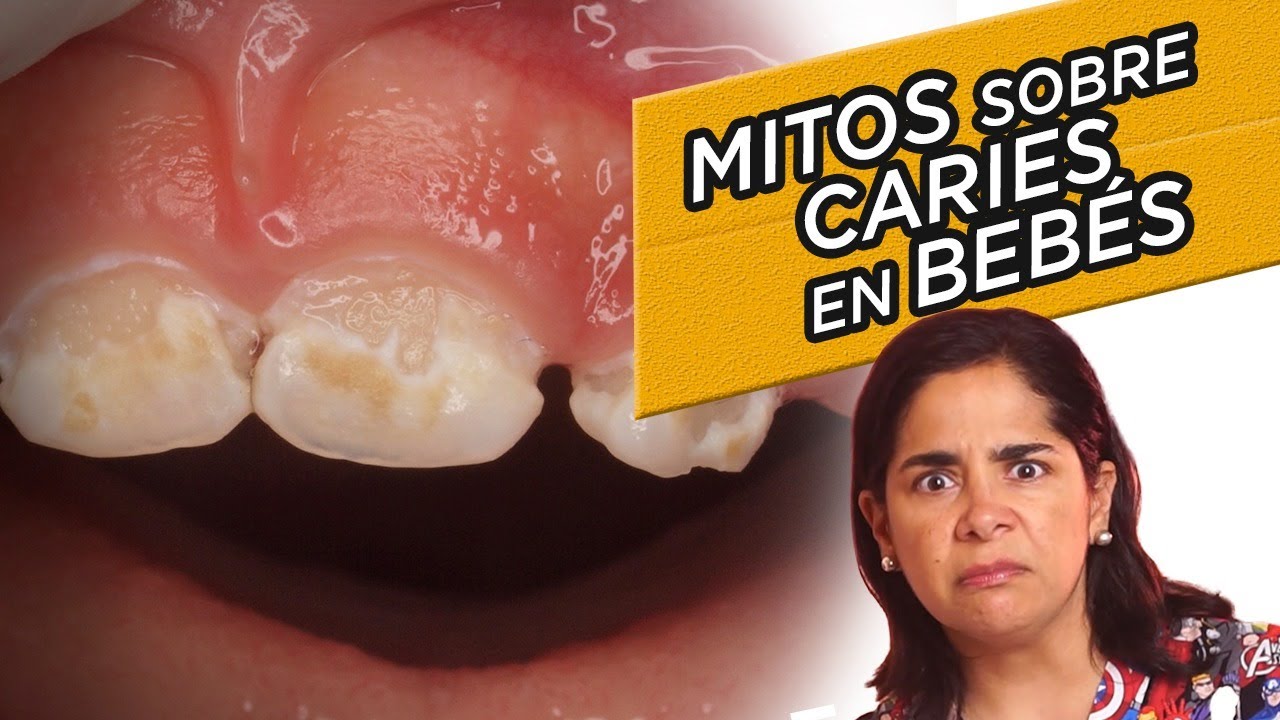 Caries en Bebés: MITOS - YouTube