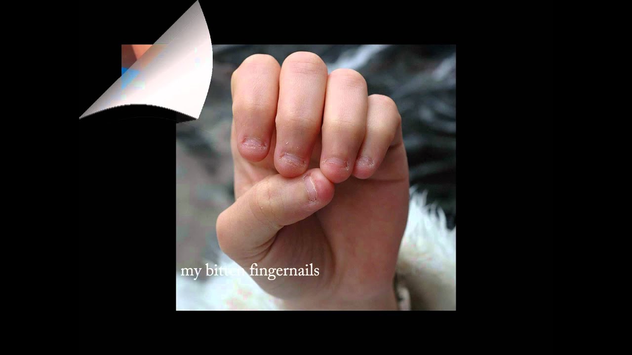 my bitten nails - YouTube