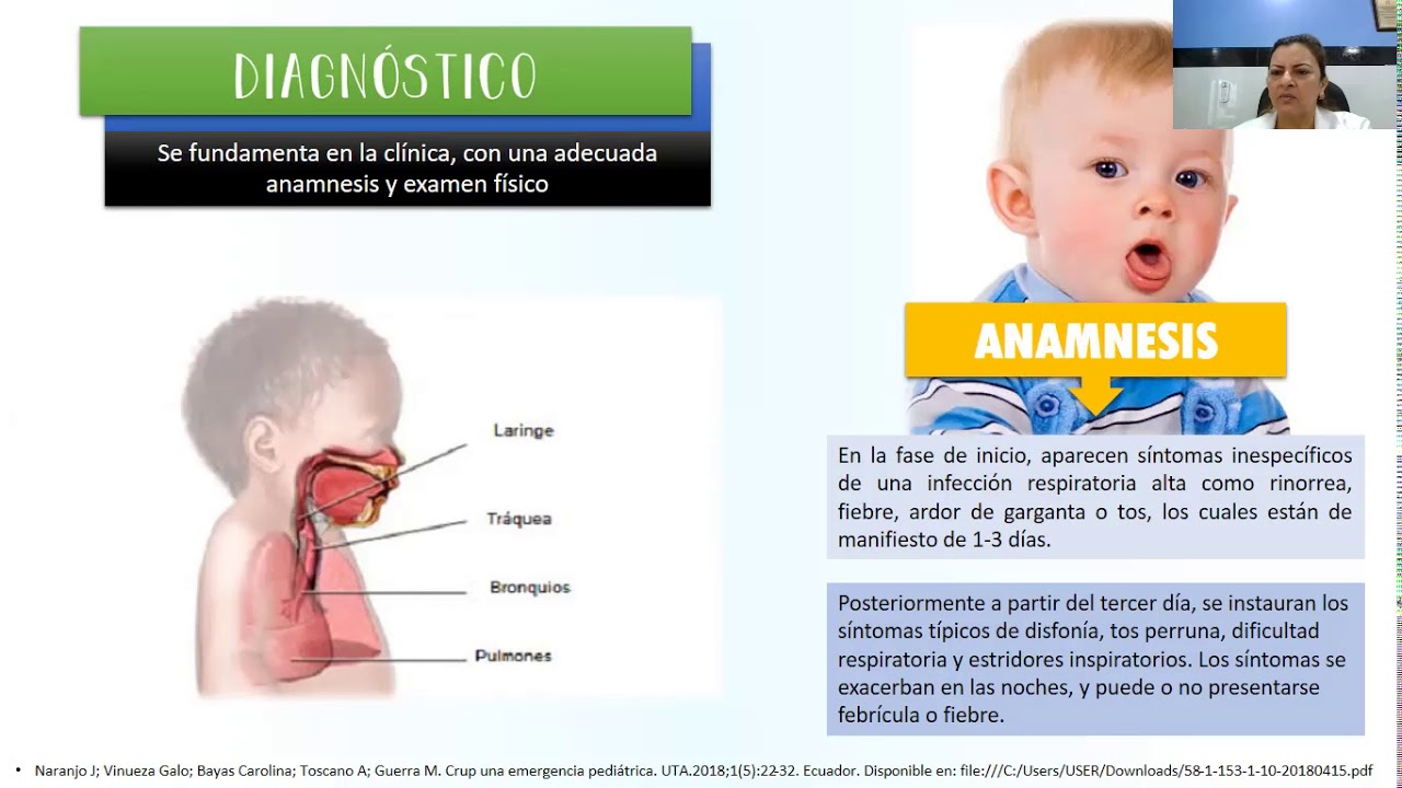 crup laringitis - YouTube