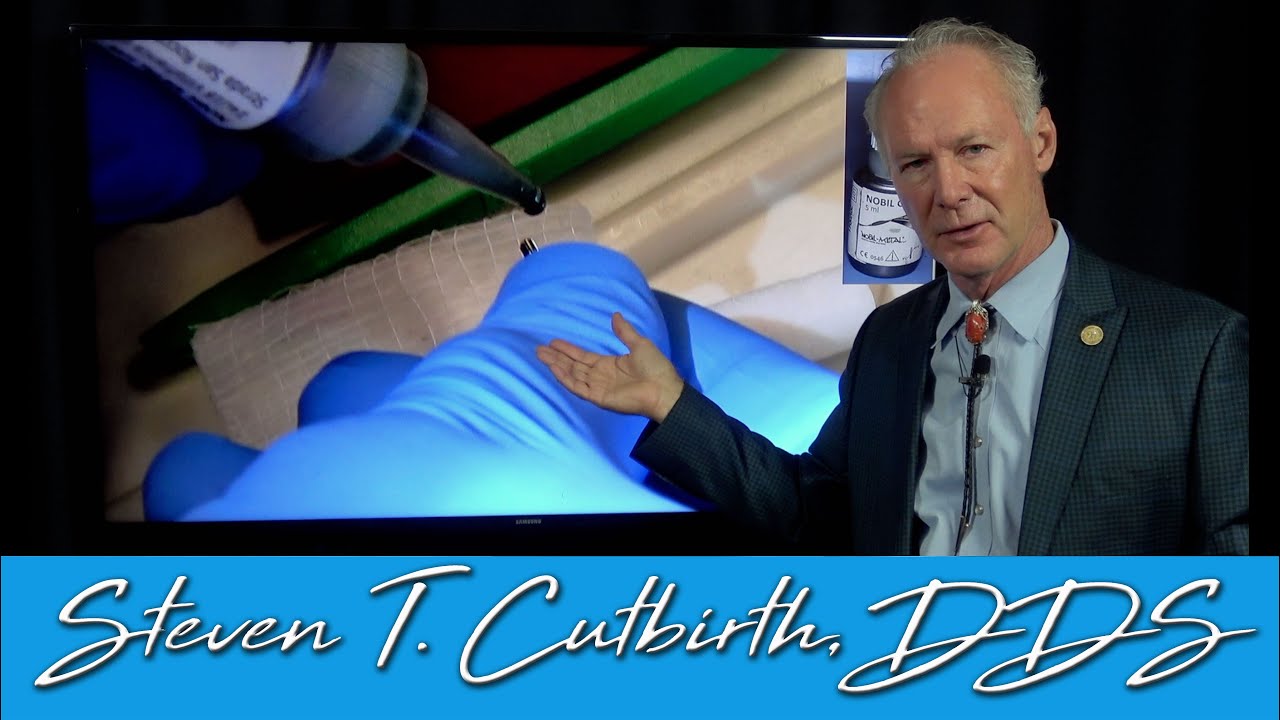 Seating an Implant Crown with Nobil Grip - Dental Minute with Steven T ...