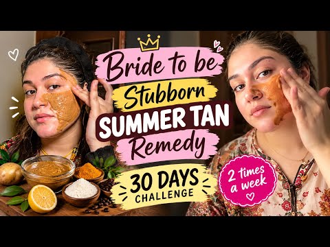 Bride To Be : Easy & Simple Summer Tan Removal Remedy || 30 Days Challenge || Shaadi Diaries Ep 5