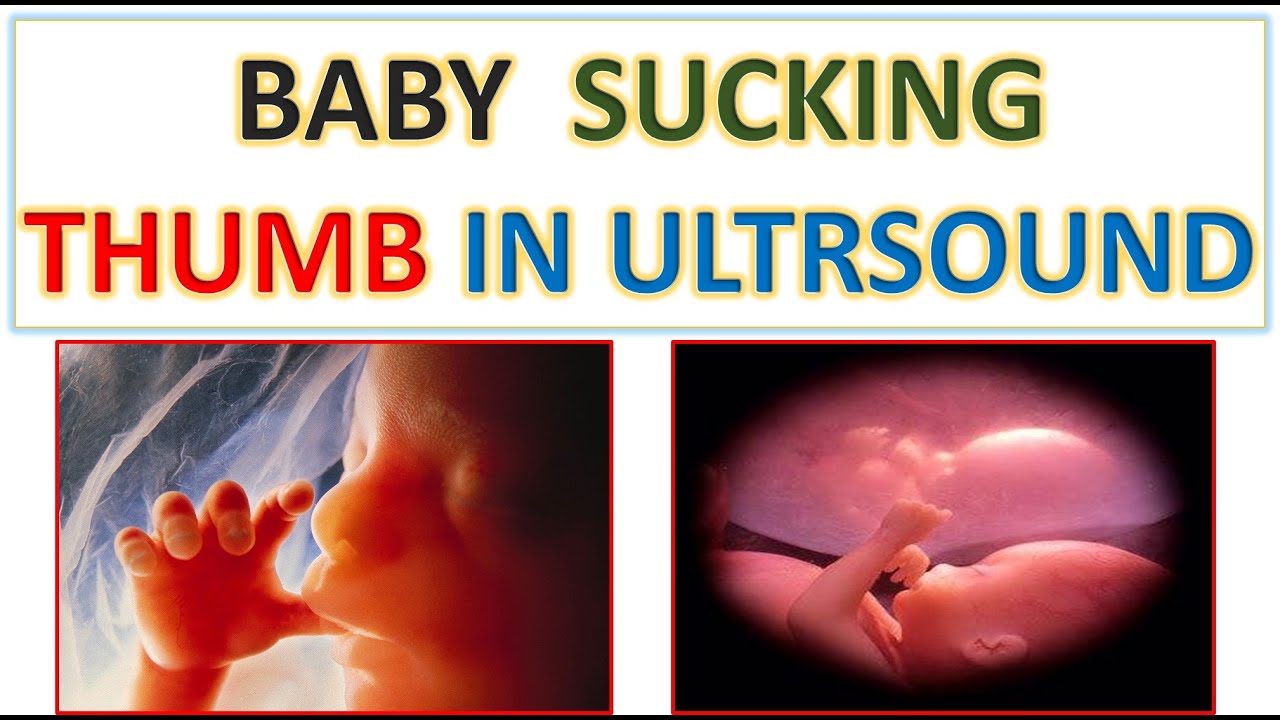 BABY THUMB SUCKING REFLEX ON ULTRASOUND SCAN | NATURAL REFLEX| BABY IS ...
