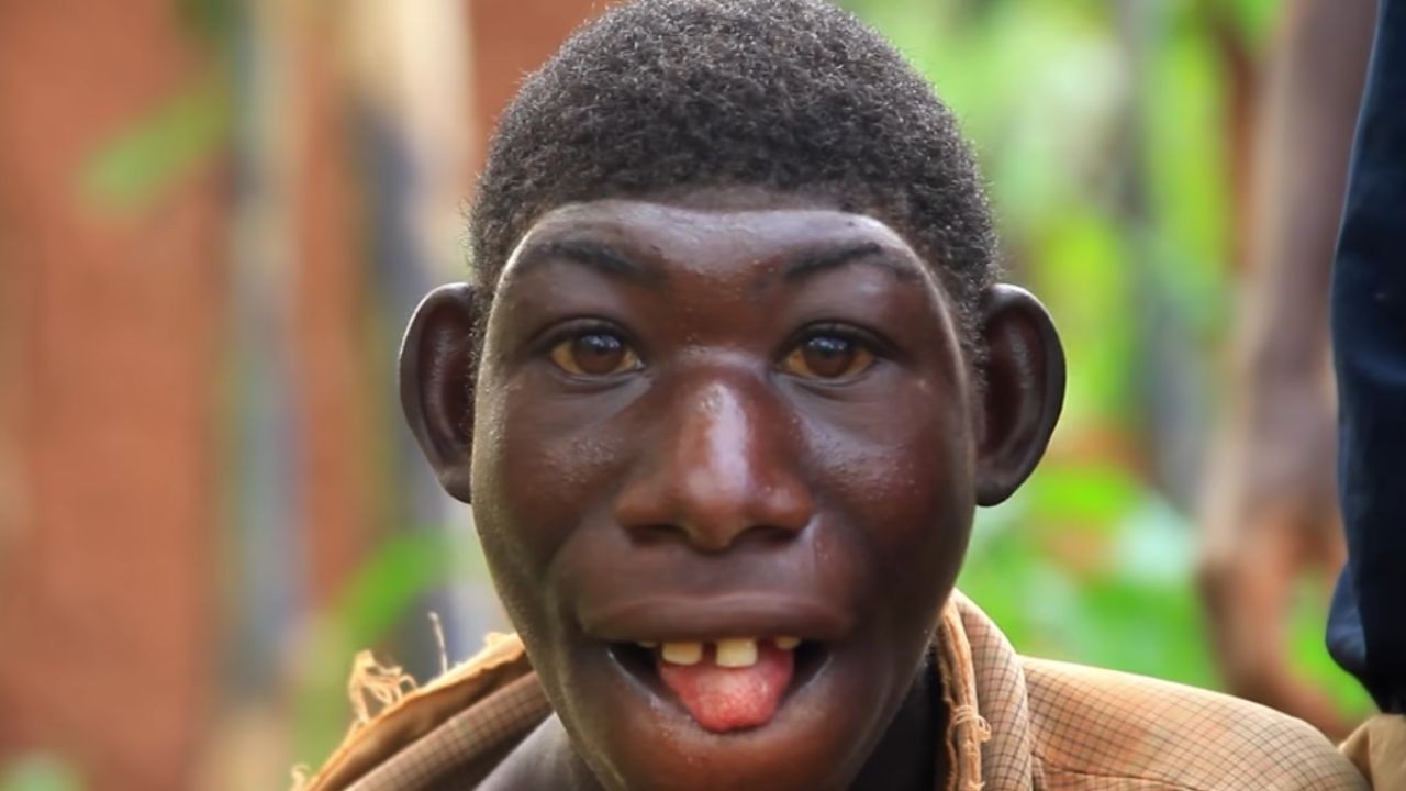 Born Different in Rwanda—The Real Story of Zanziman Ellie and the Truth ...