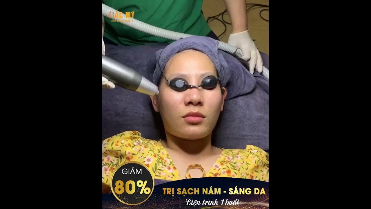 Điều trị nám da chỉ một liệu trình duy nhất tại TMV Quốc Tế Bắc Mỹ - YouTube