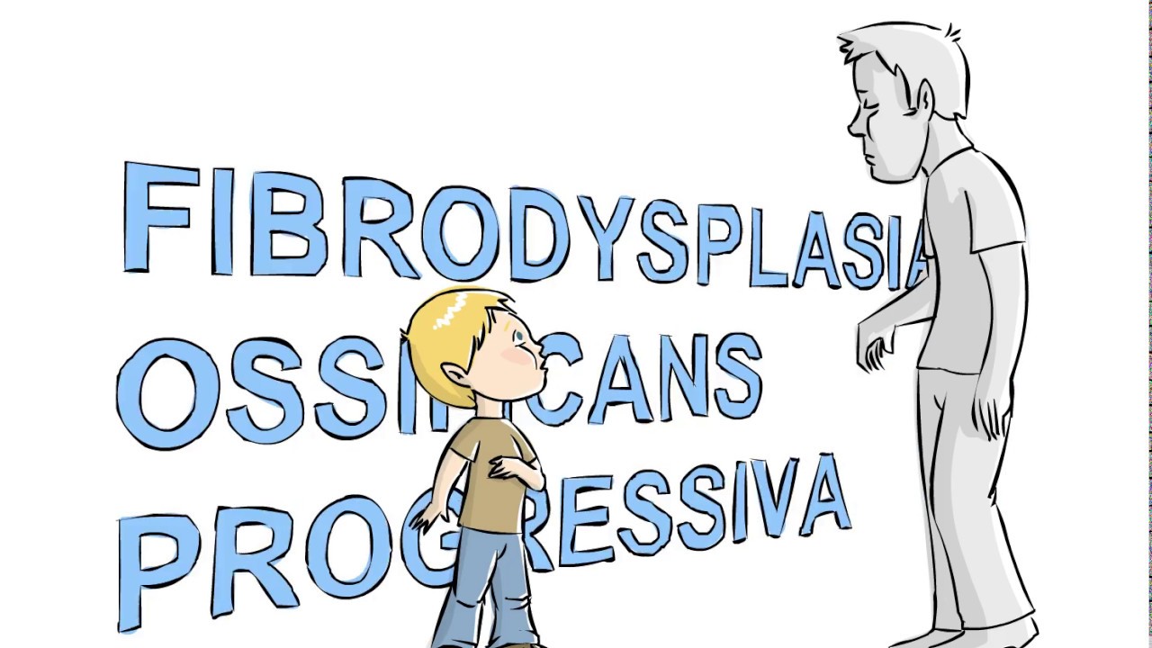 What Is FOP? - YouTube