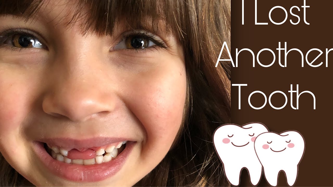 I Lost Another Tooth, All I Want For Christmas is My Two Front Teeth ...