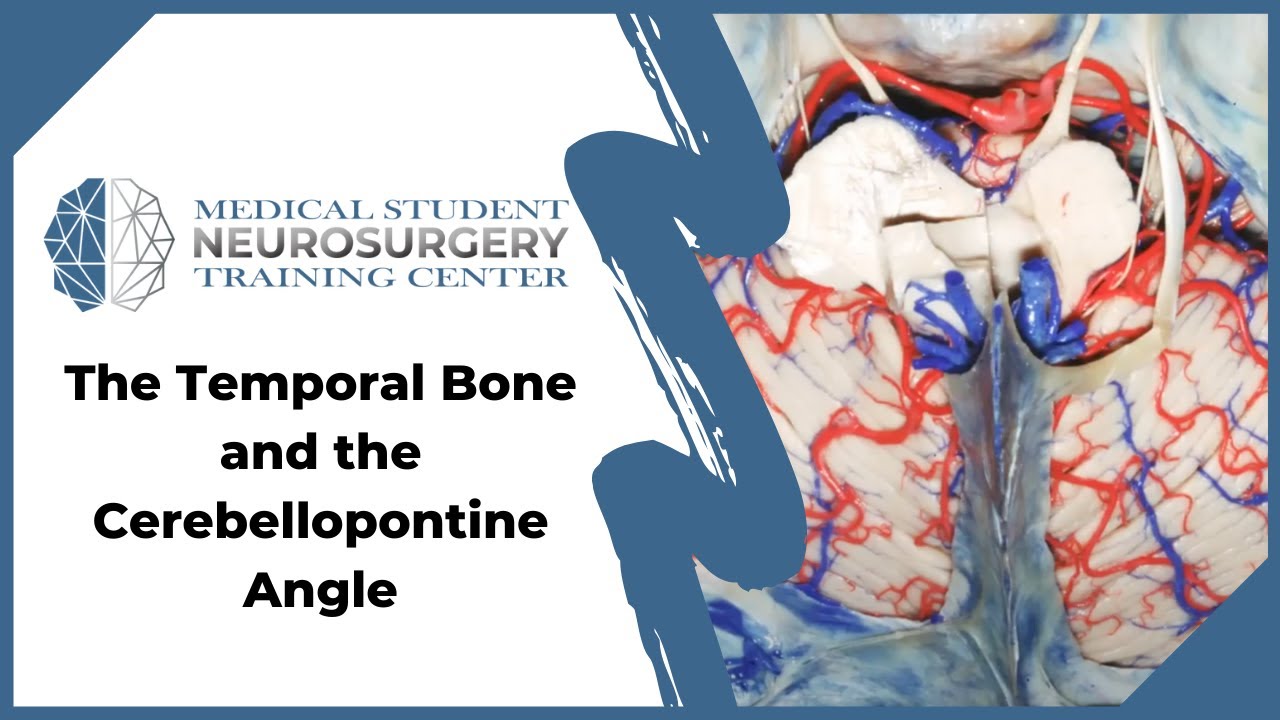 The Temporal Bone and the Cerebellopontine Angle - YouTube