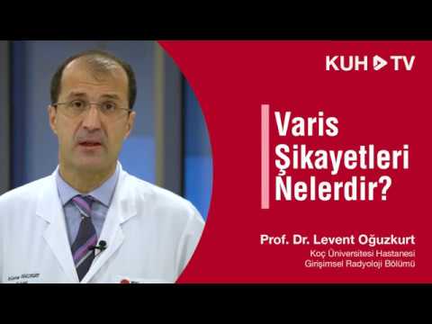 Varis hastalarının şikayetleri nelerdir? Prof. Dr. Levent Oğuzkurt
