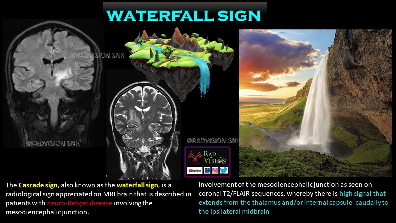 SIGNS IN RADIOLOGY SET VII - YouTube