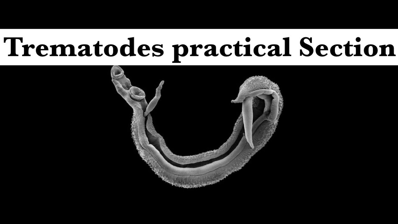 Parasitology practical part 1 (Trematodes section) - YouTube