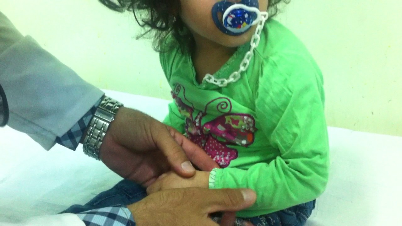 pulled elbow the most common upperlimb injury in children, - YouTube