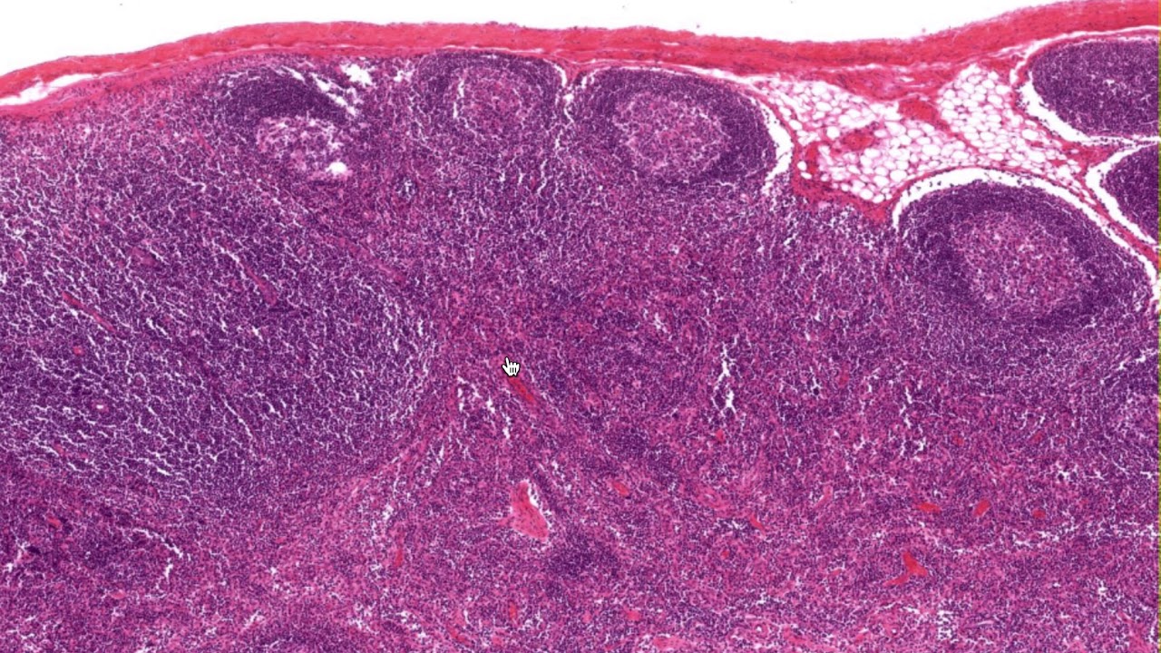 HISTOLOGI (LYMFOIDE ORGANER): LYMFEKNUTE - YouTube