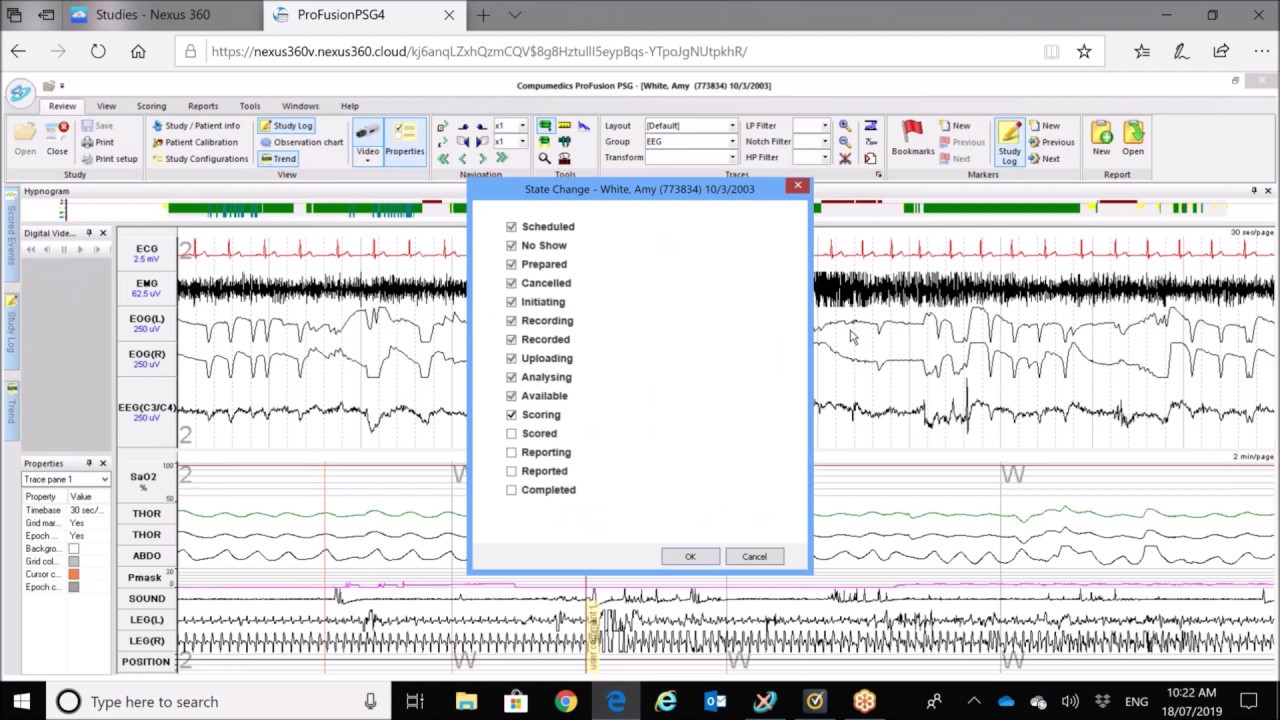 Compumedics Profusion neXus 360 Changing Study States v1 - YouTube