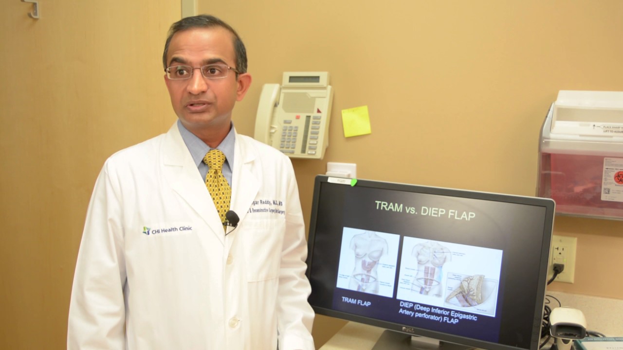 DIEP Flap - A New Reconstructive Option for Breast Cancer Patients ...