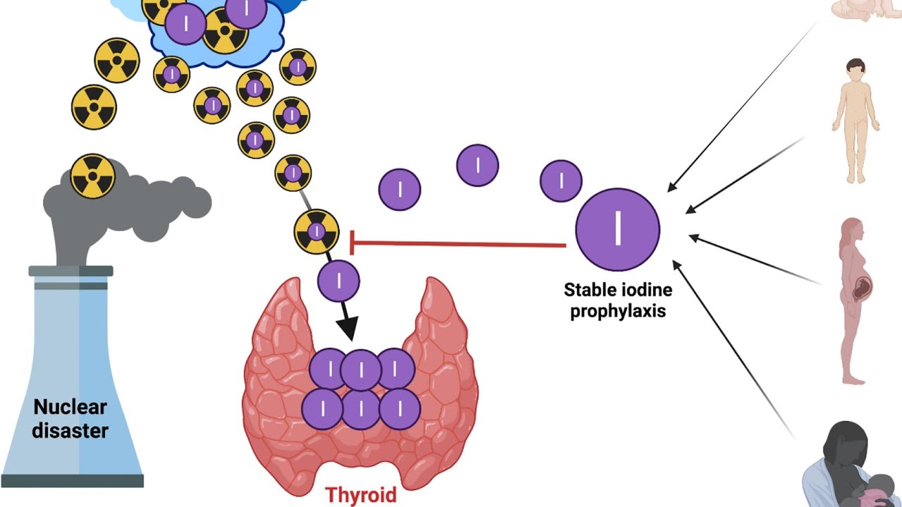 Iodinated Contrast media Induced Hyperthyroidism ; Causes, Risk factors ...