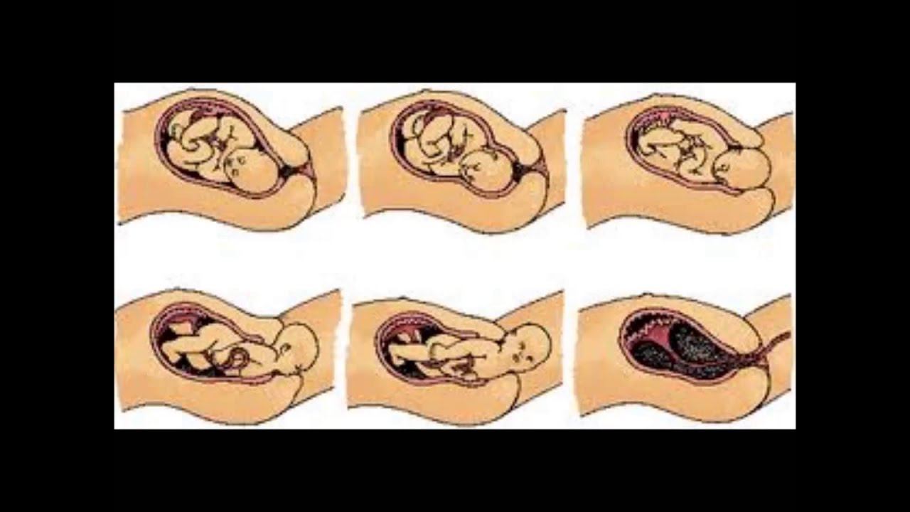 Embarazo y Parto - YouTube