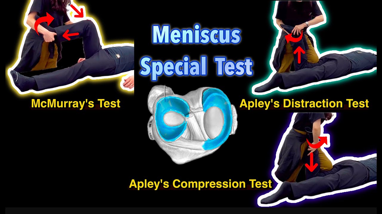 Meniscus Tear McMurrays Test, Apley’s Test. Function and Anatomy of ...