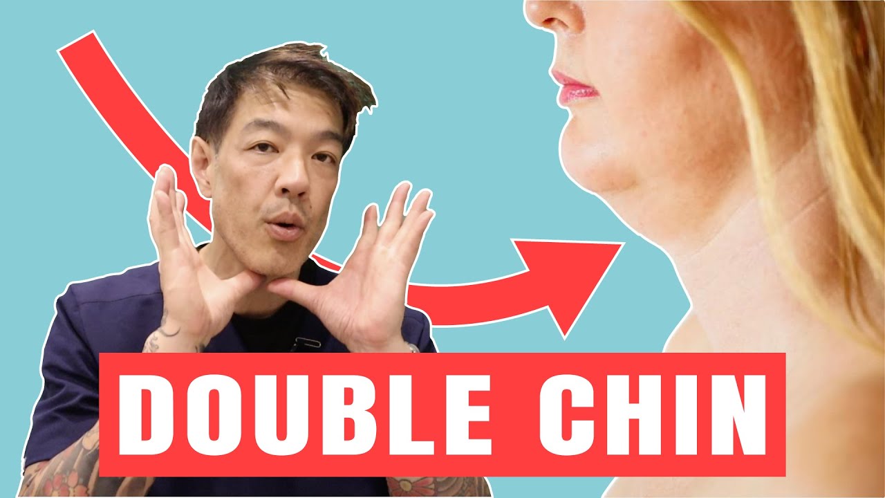 How to Get Rid of a Double Chin | Dr Davin Lim - YouTube
