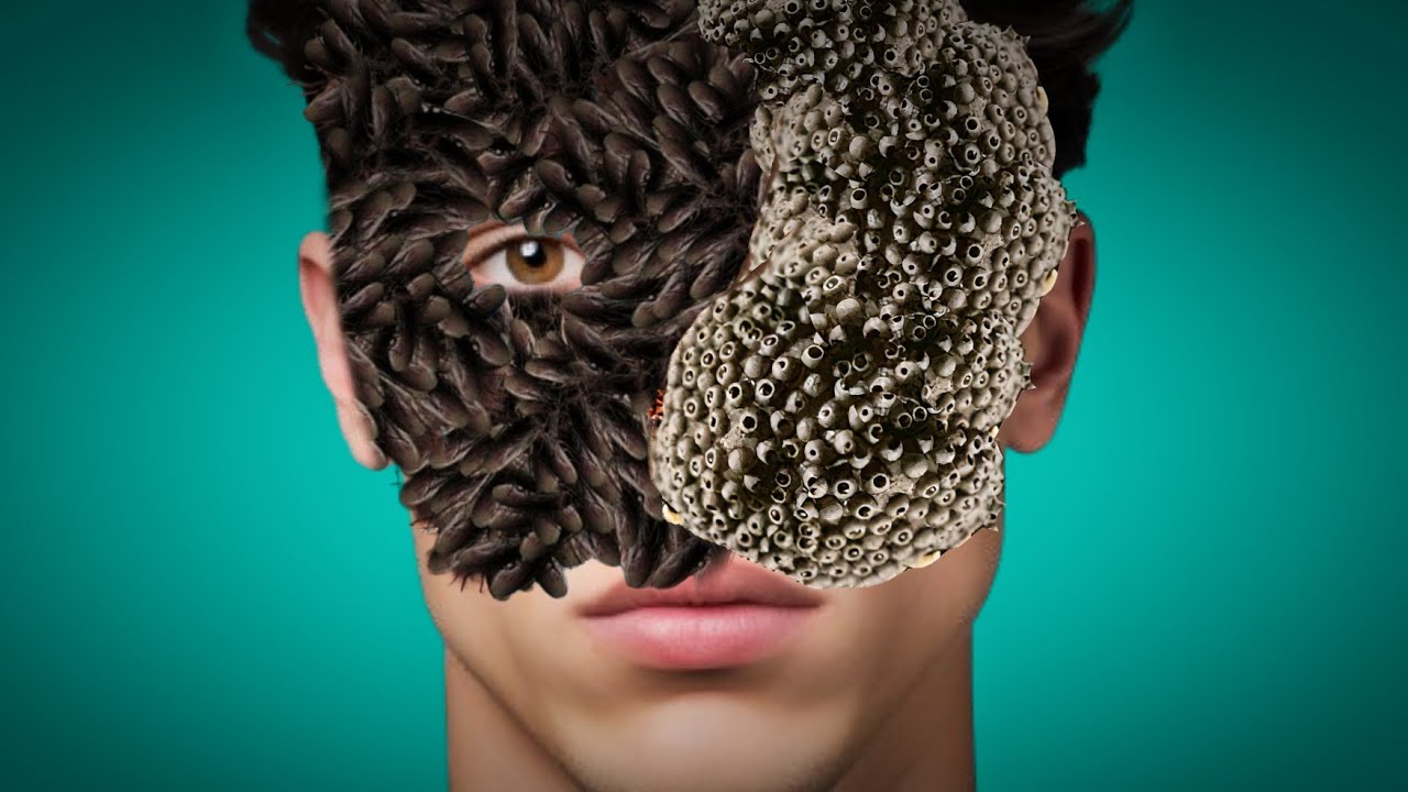 ASMR maggot remove infected face | ASMR 2d deep cleaning animation ...