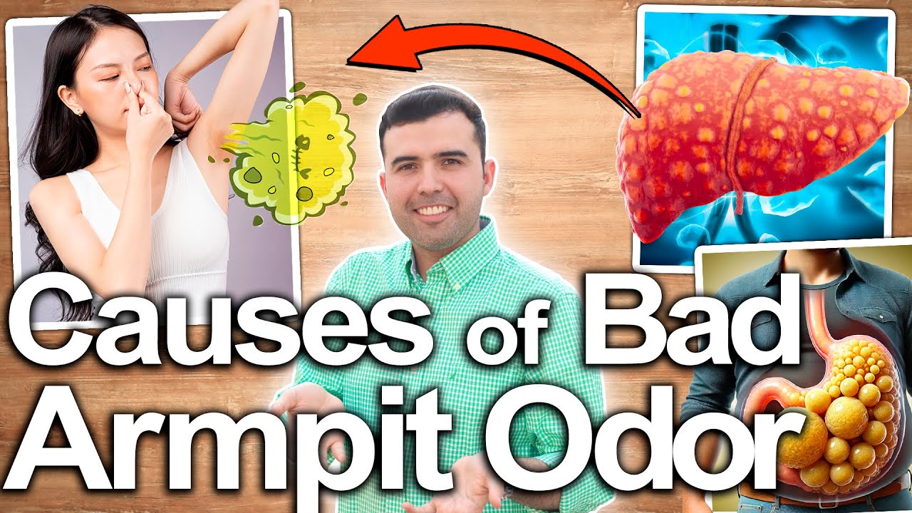WHY DO YOUR ARMPITS SMELL AND HOW TO FIX IT - Causes and Diseases - YouTube
