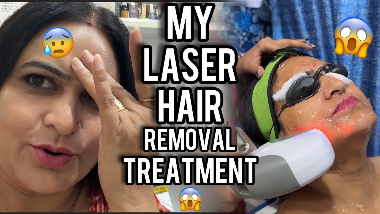 My full body laser treatment😢 - YouTube