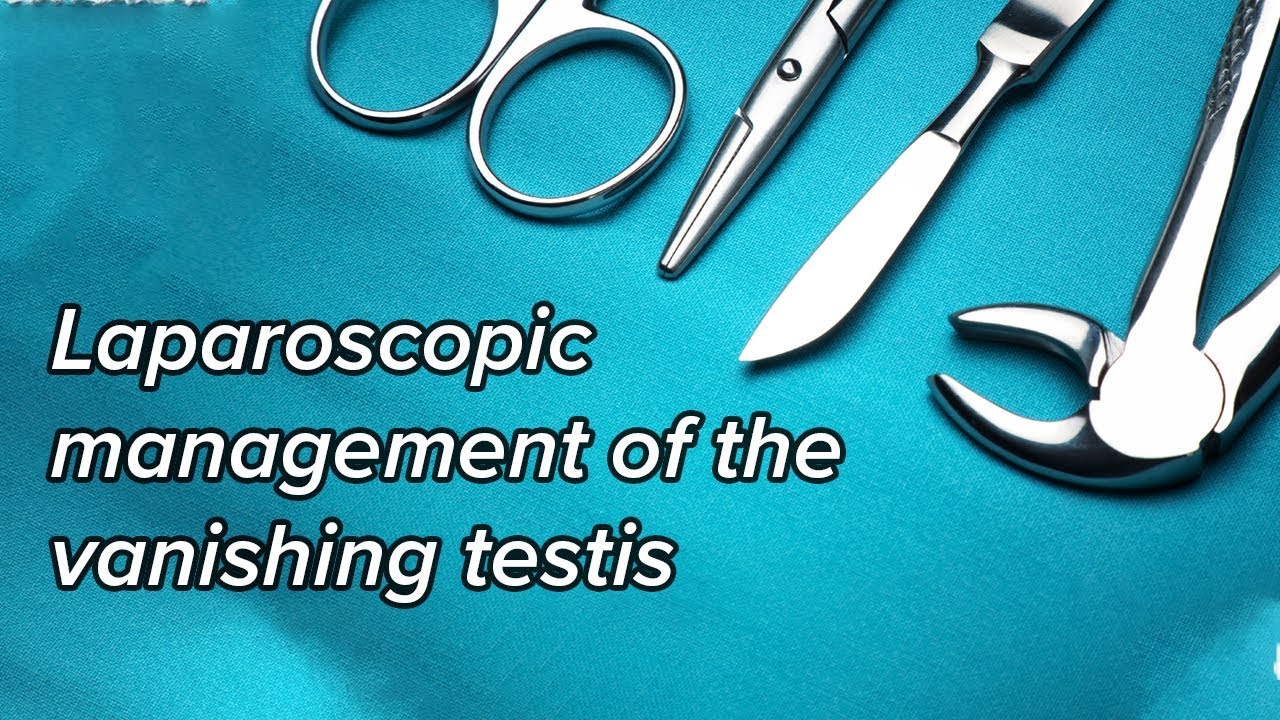 Laparoscopic management of the vanishing testis | Cryptorchidism - YouTube