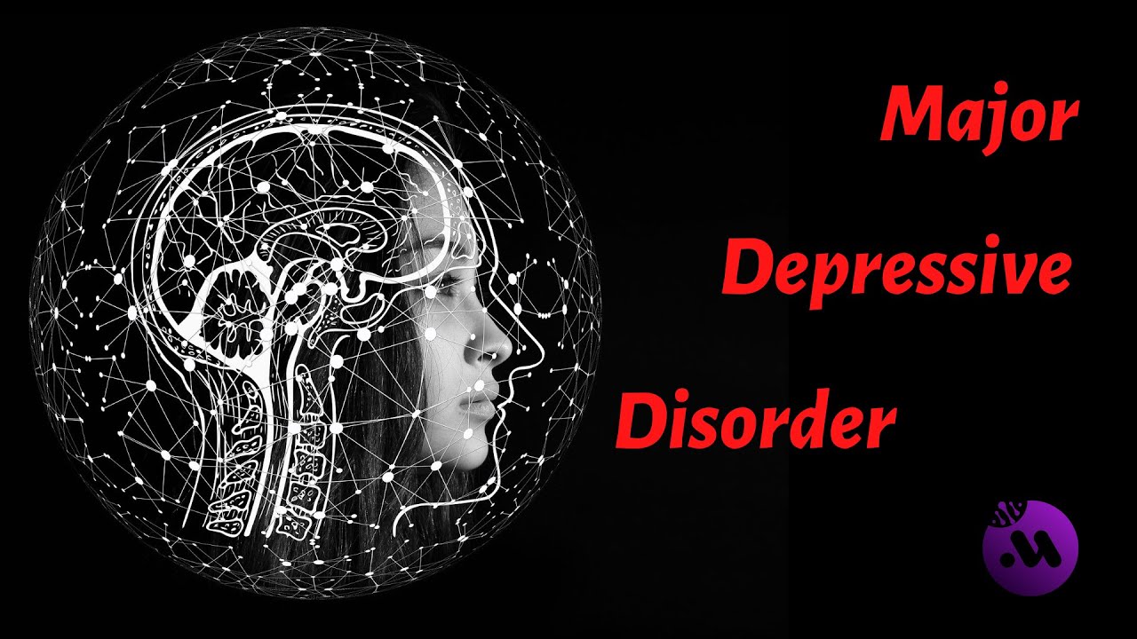 Major depressive disorder (MDD) | DSM-5 diagnostic criteria | Symptoms ...
