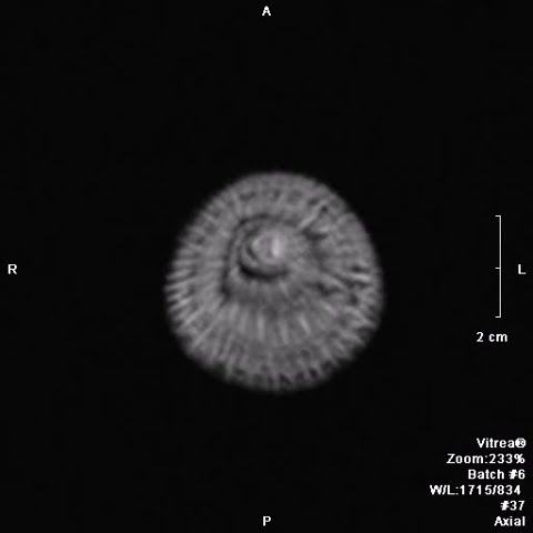 Onion in the MRI lab - YouTube