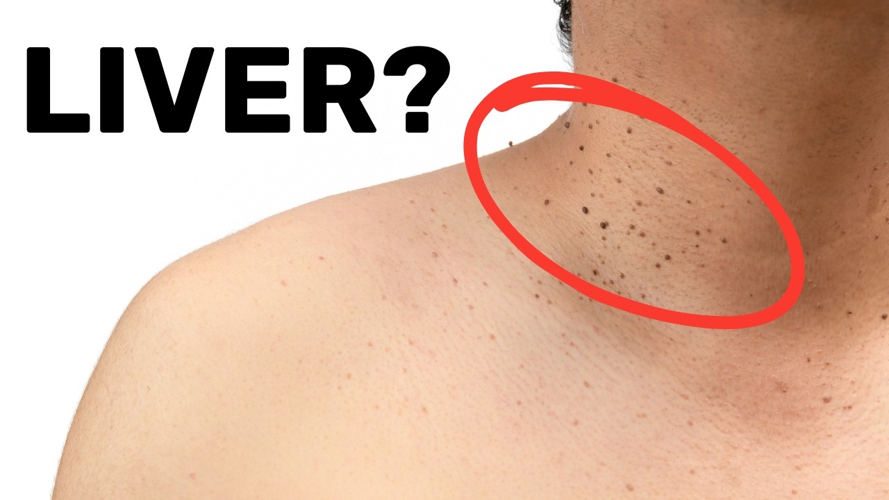 This Skin Change Means Your Liver is in Danger! - YouTube