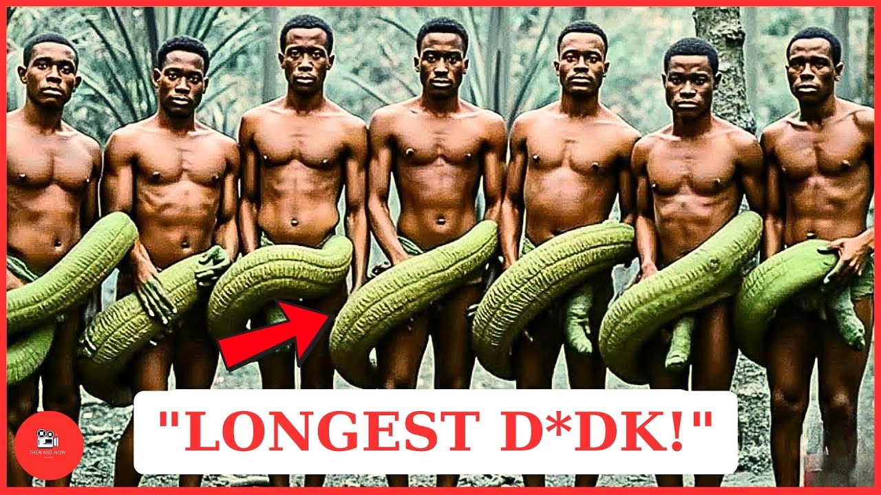 LIVE:25 Real-Life Stories of Extraordinary Body Features Around the ...