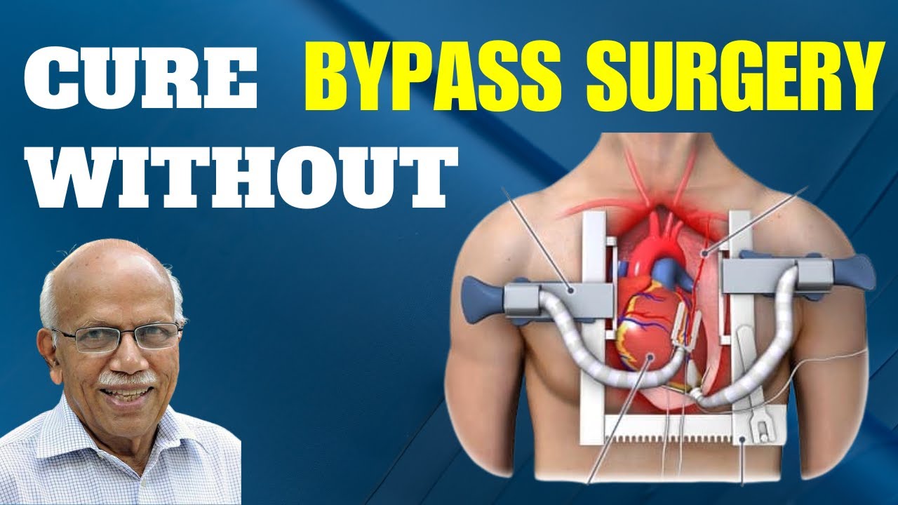 Solution For Bypass Surgery - Dr. B M Hegde - YouTube