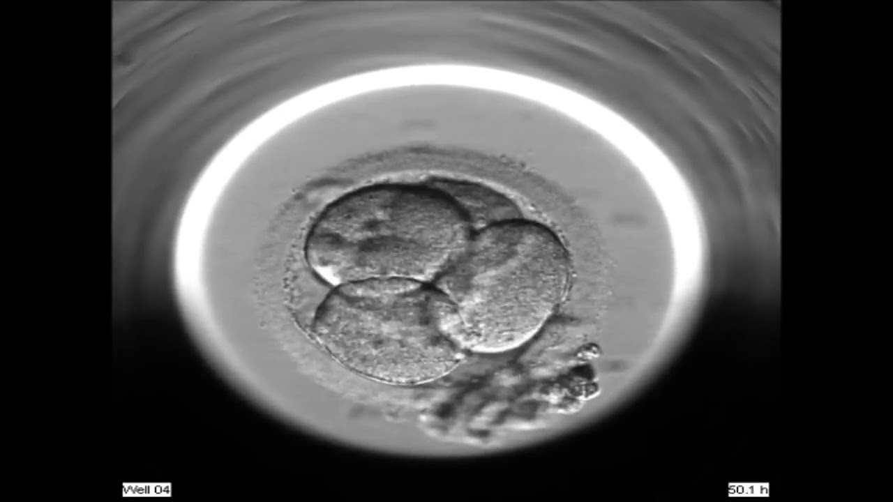 Embryoscope at Fertility Specialists of WA - YouTube