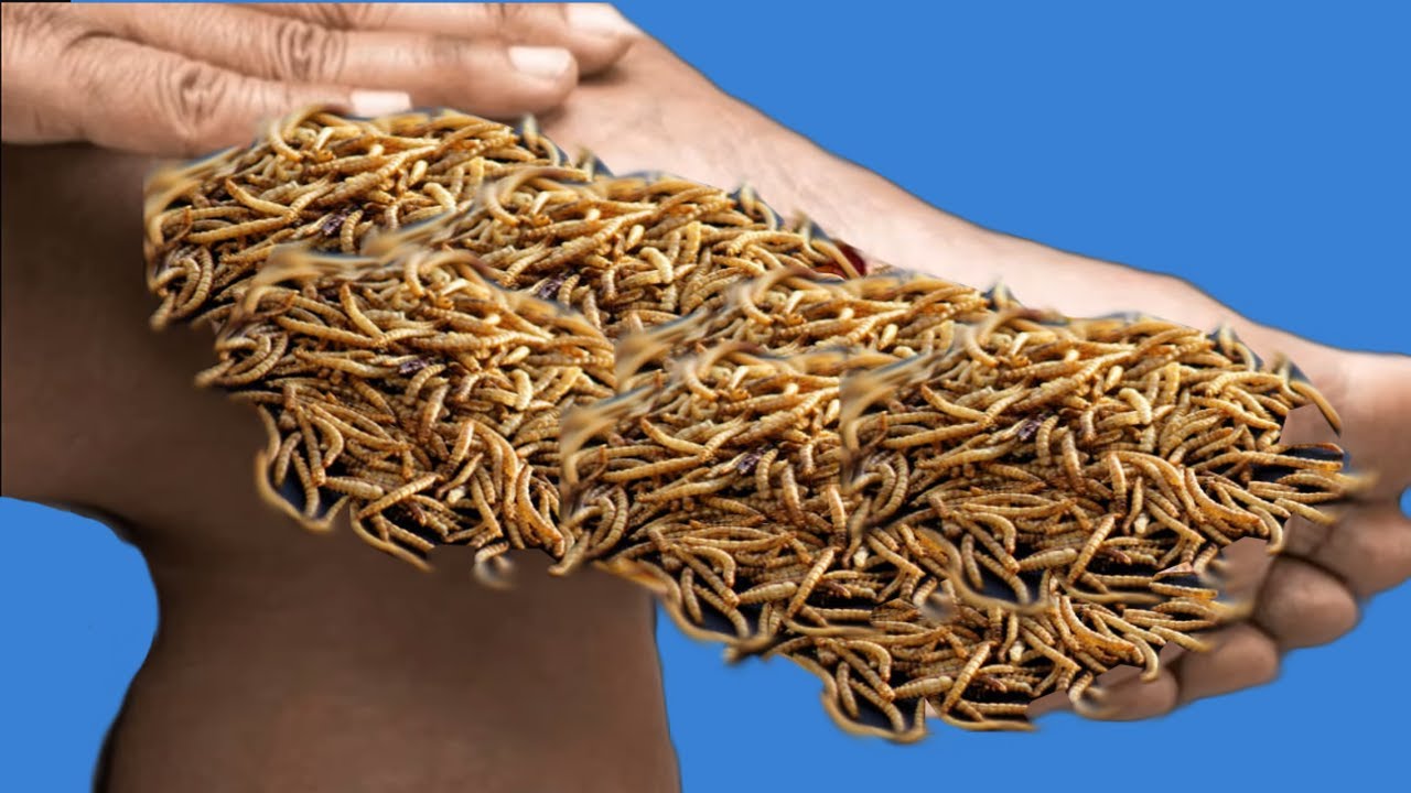 ASMR Remove dog ticks & Trypophobia Infected Feet | ASMR Animation ...